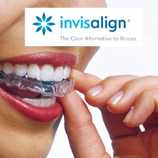We are now an Official Invisalign Provider! | Eyes & Smiles - Expert 5 ...